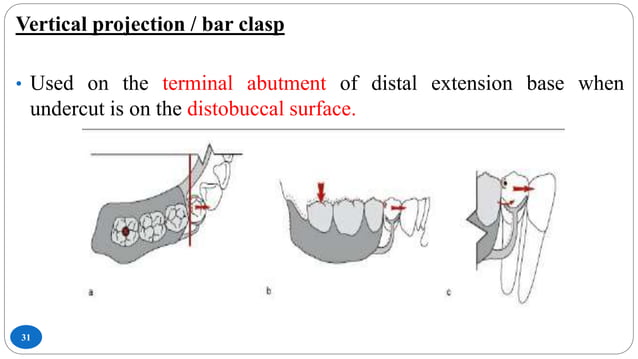 RPI & RPA system | PPTX | Dental Health | Diseases and Conditions