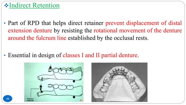 RPI & RPA system | PPTX | Dental Health | Diseases and Conditions