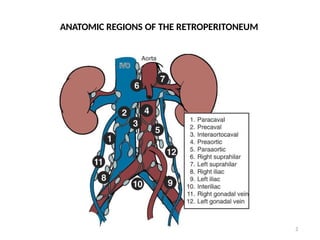 RETRO PERITONEAL LYMPHNODE DISSECTION CA | PPTX