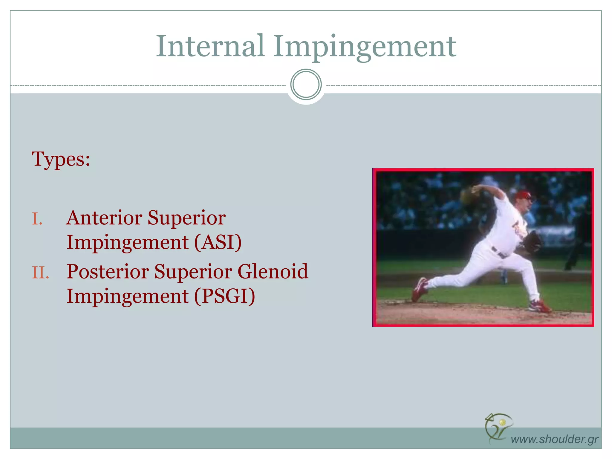 Impingement syndromes | PPTX