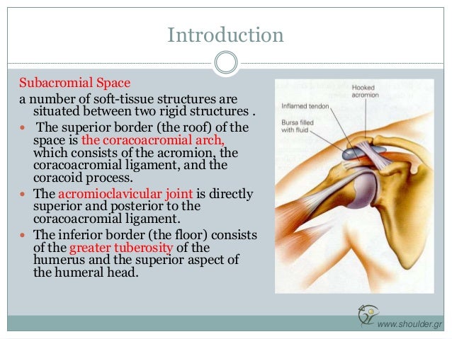 Impingement syndromes