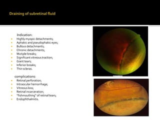 Rhegmatogenous Retinal Detachment --RRD | PPT