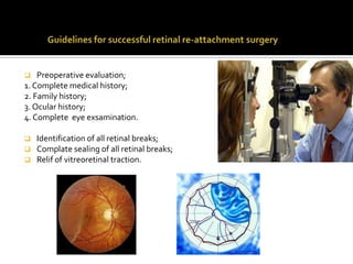 Rhegmatogenous Retinal Detachment --RRD | PPTX