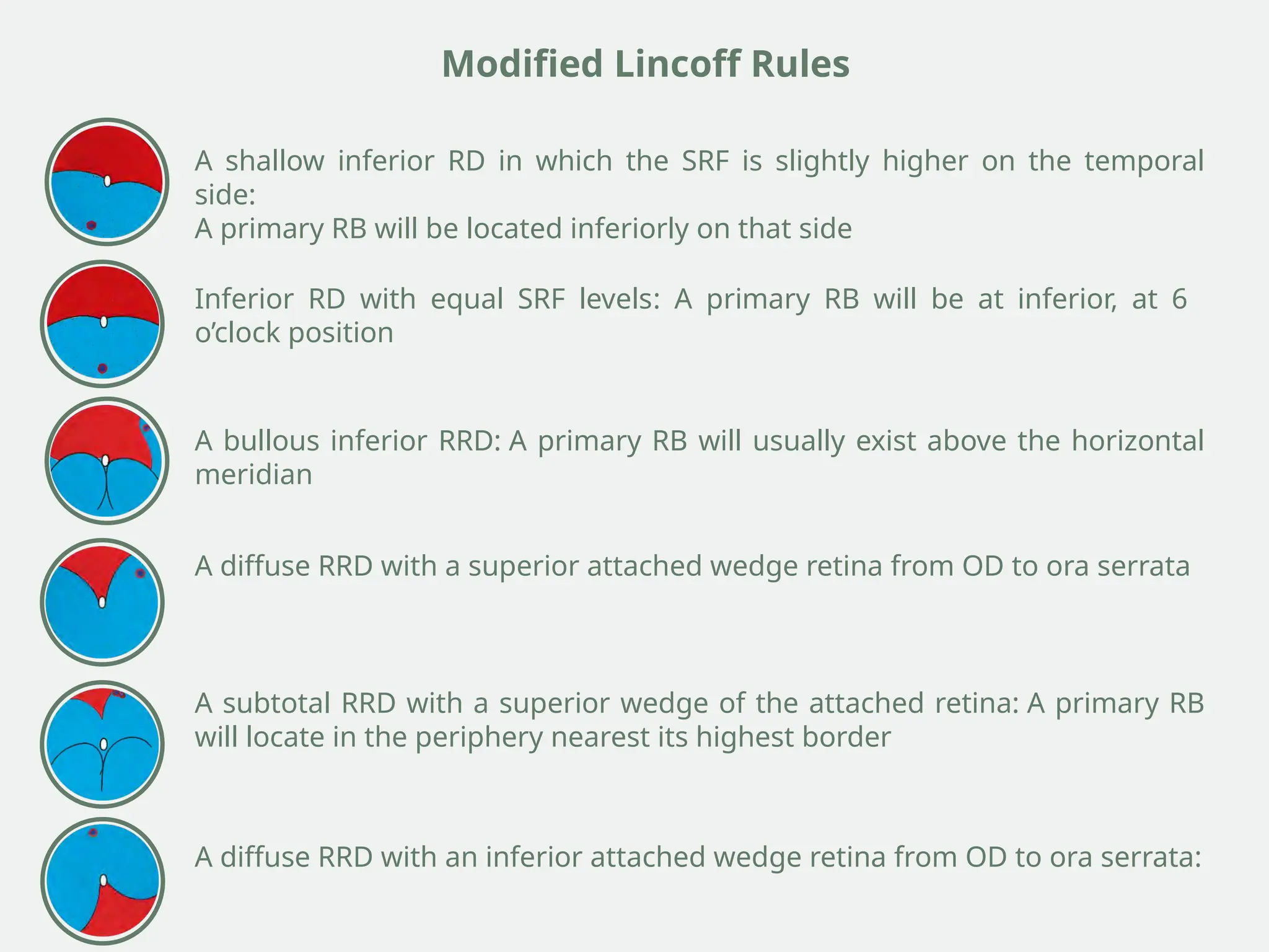 Rhegmetogenous Retinal Detachment- treatment and diagnosis.pptx