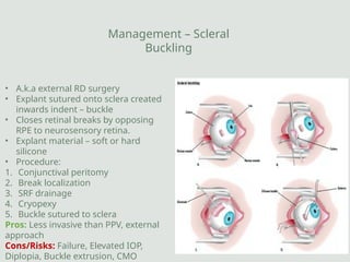 Rhegmetogenous Retinal Detachment- treatment and diagnosis.pptx