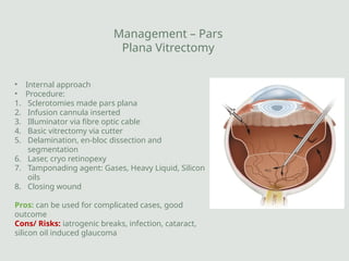 Rhegmetogenous Retinal Detachment- treatment and diagnosis.pptx