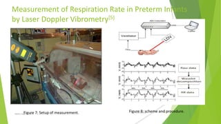 Respiratory Rate Measurement | PPTX