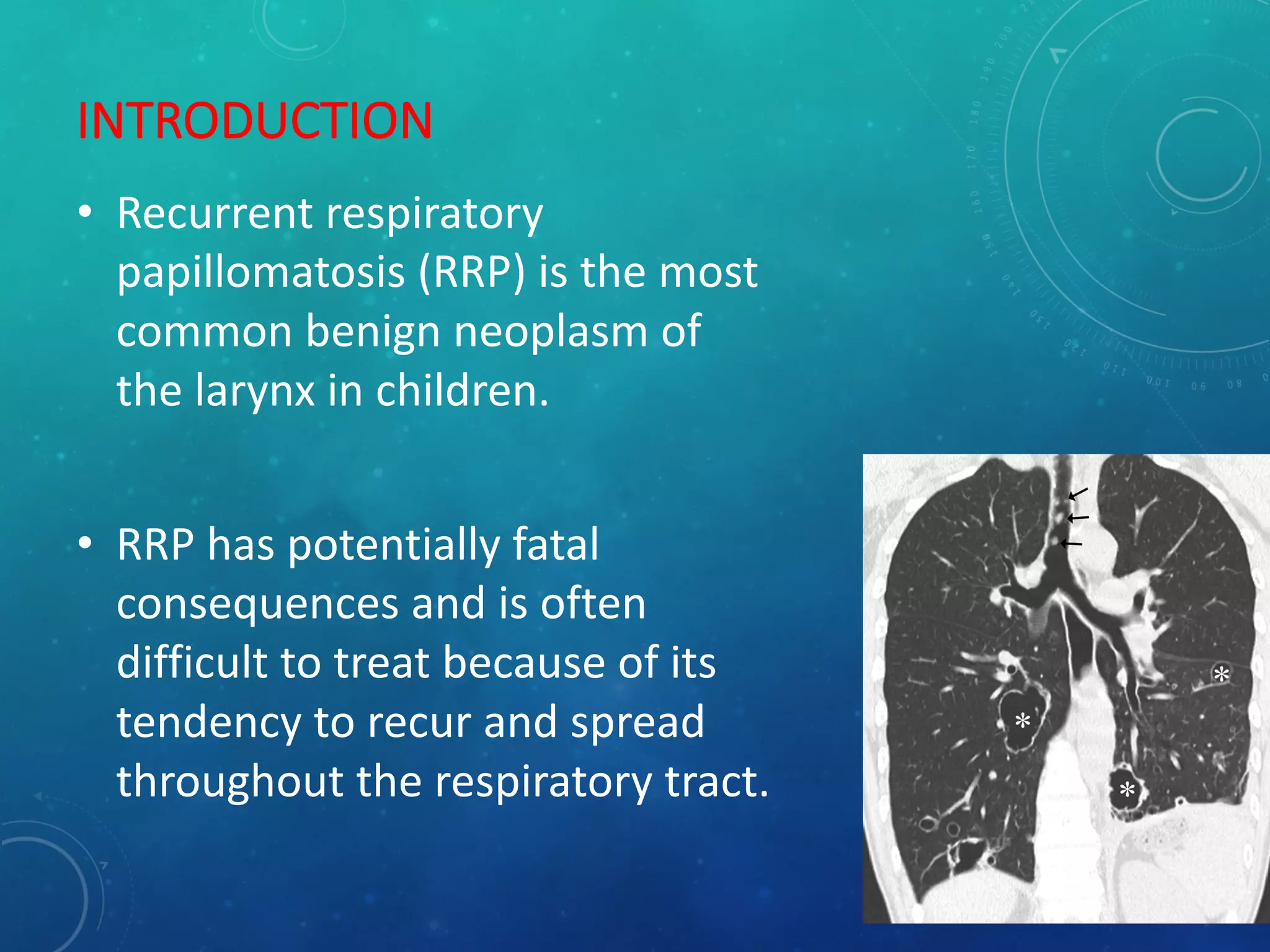 recurrent respiratory papillomatosis | PDF