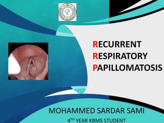 recurrent respiratory papillomatosis | PDF