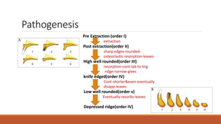RESIDUAL RIDGE RESORPTION | PPT