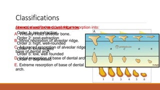 RESIDUAL RIDGE RESORPTION | PPTX