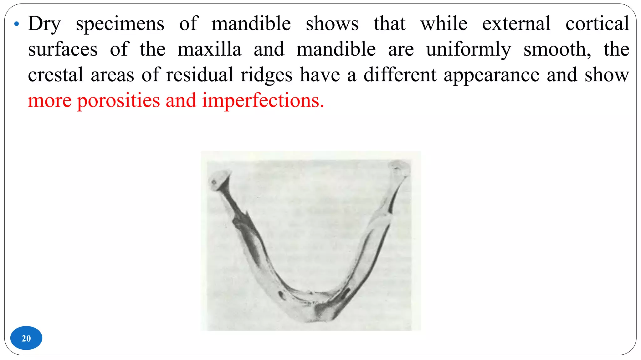 Resisual Ridge Resorption | PPTX