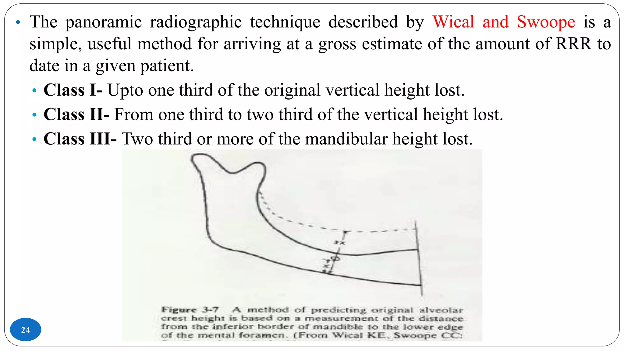 Resisual Ridge Resorption | PPTX