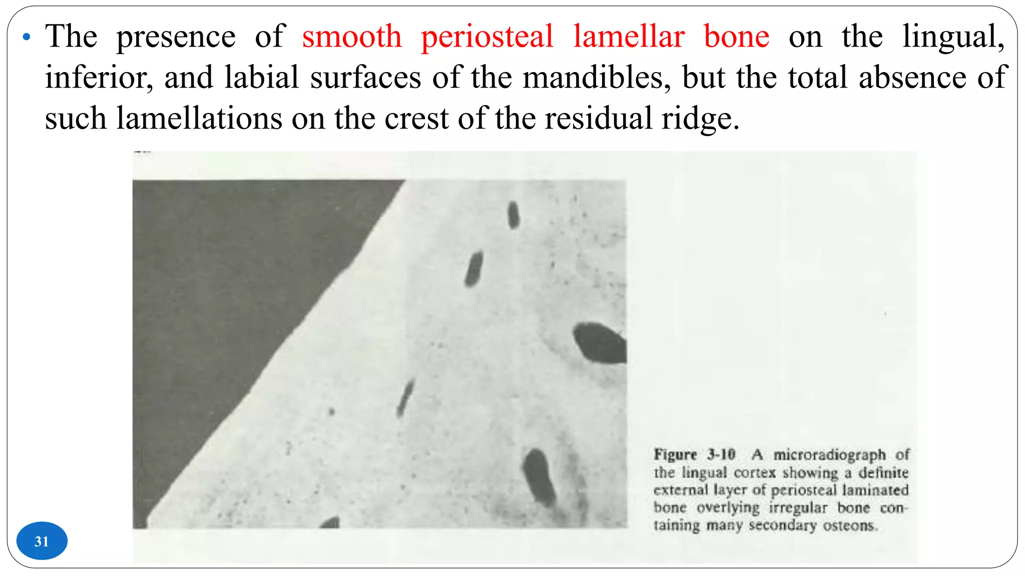Resisual Ridge Resorption | PPTX