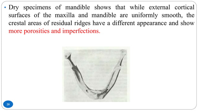 Resisual Ridge Resorption | PPTX
