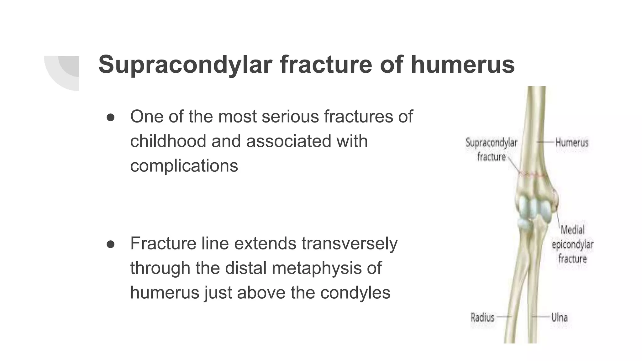 Supracondylar fracture of humerus | PPTX