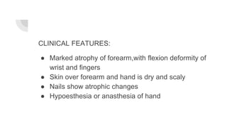 Supracondylar fracture of humerus | PPTX
