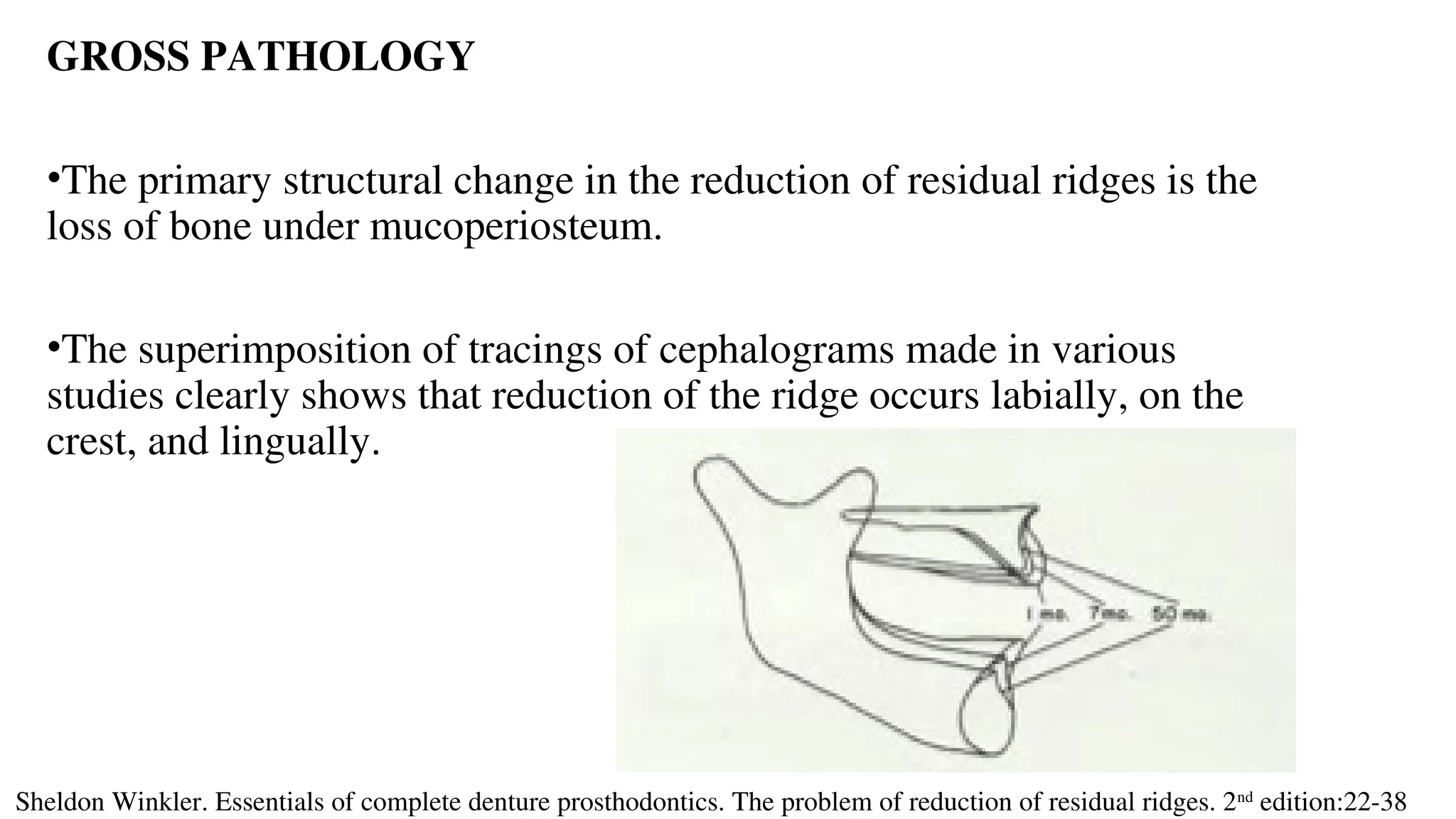 Residual Ridge Resorption in Prosthodontics .ppt
