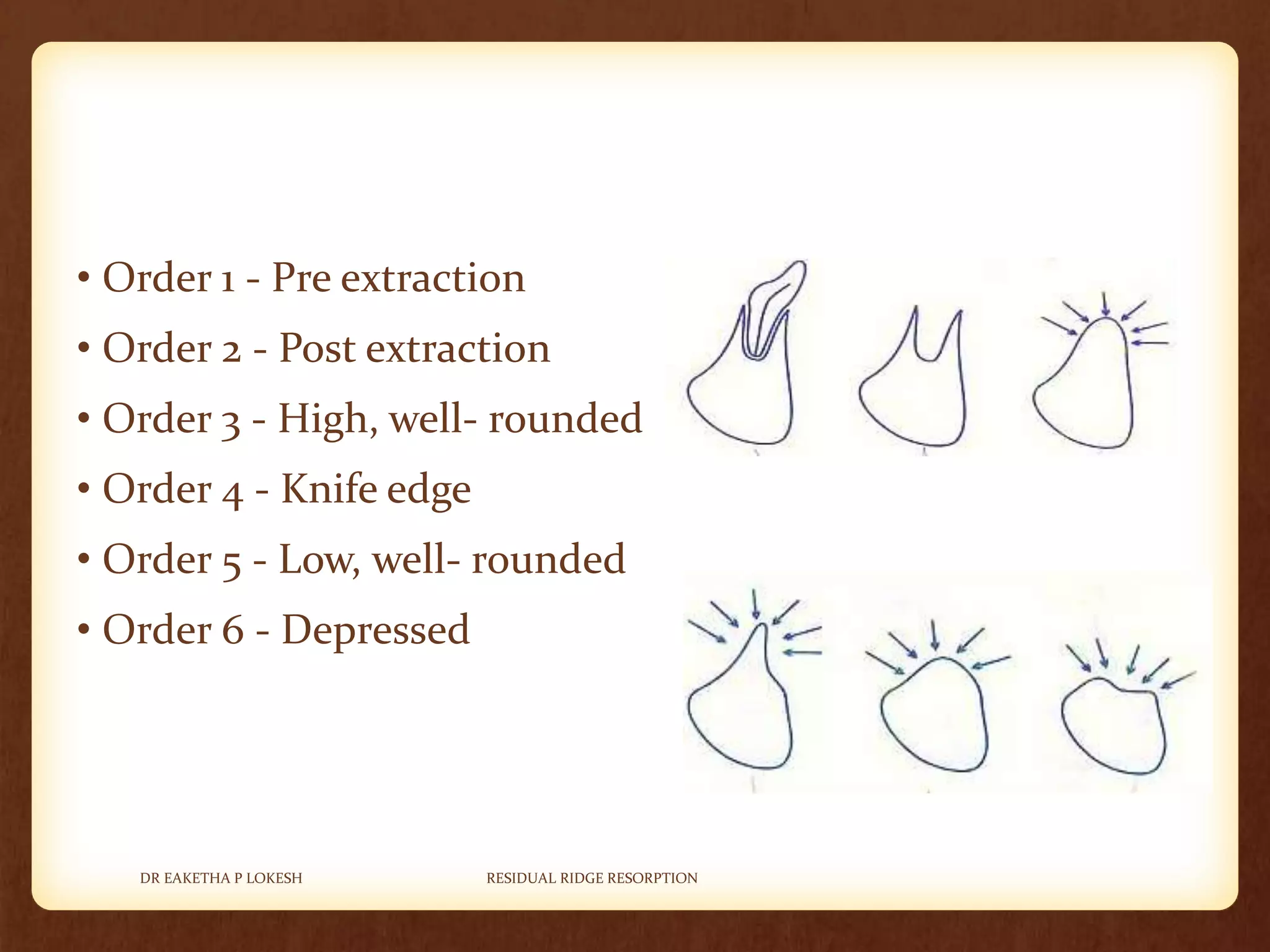 Residual ridge resorption - RRR | PPTX