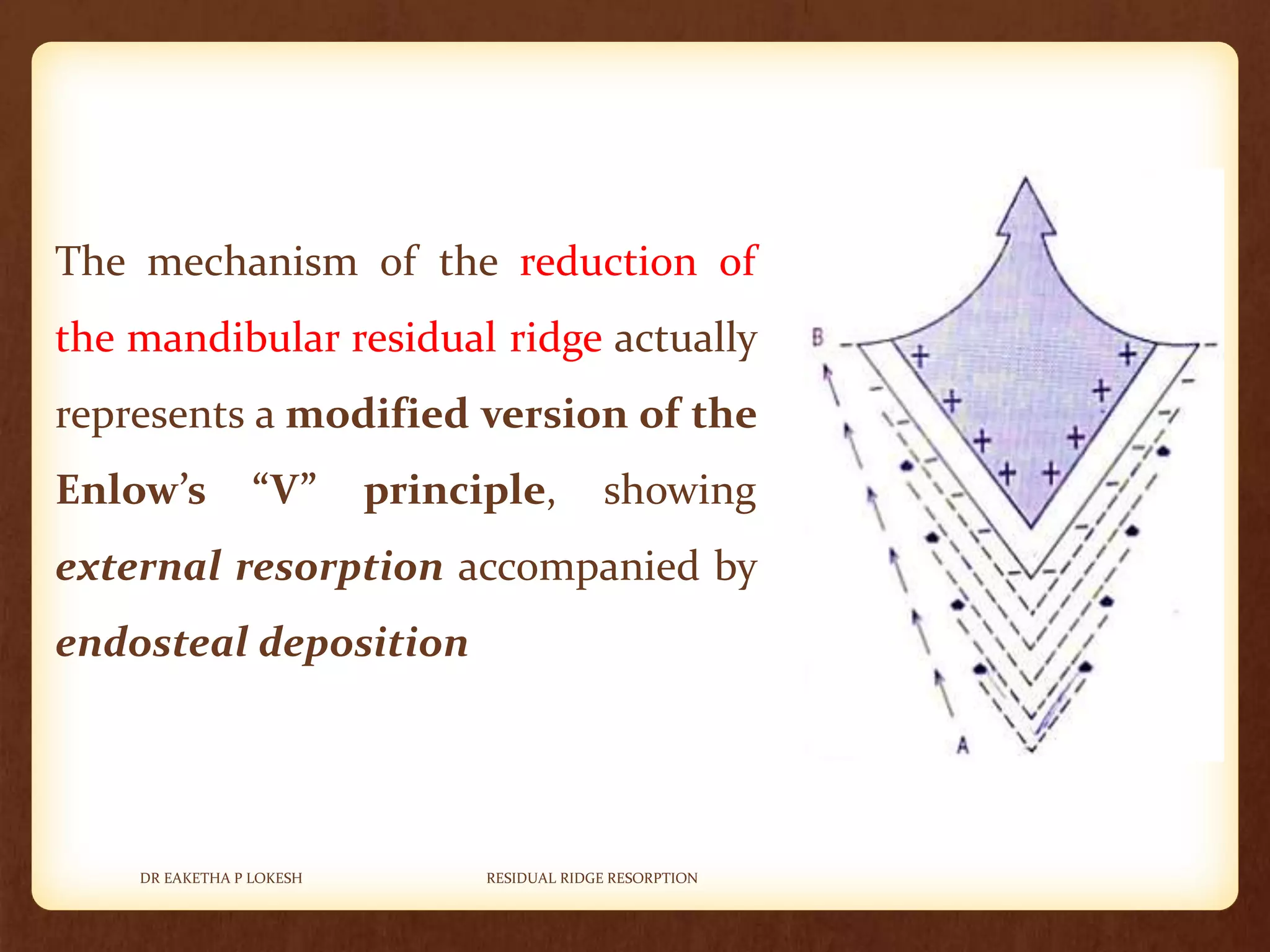 Residual ridge resorption - RRR | PPTX