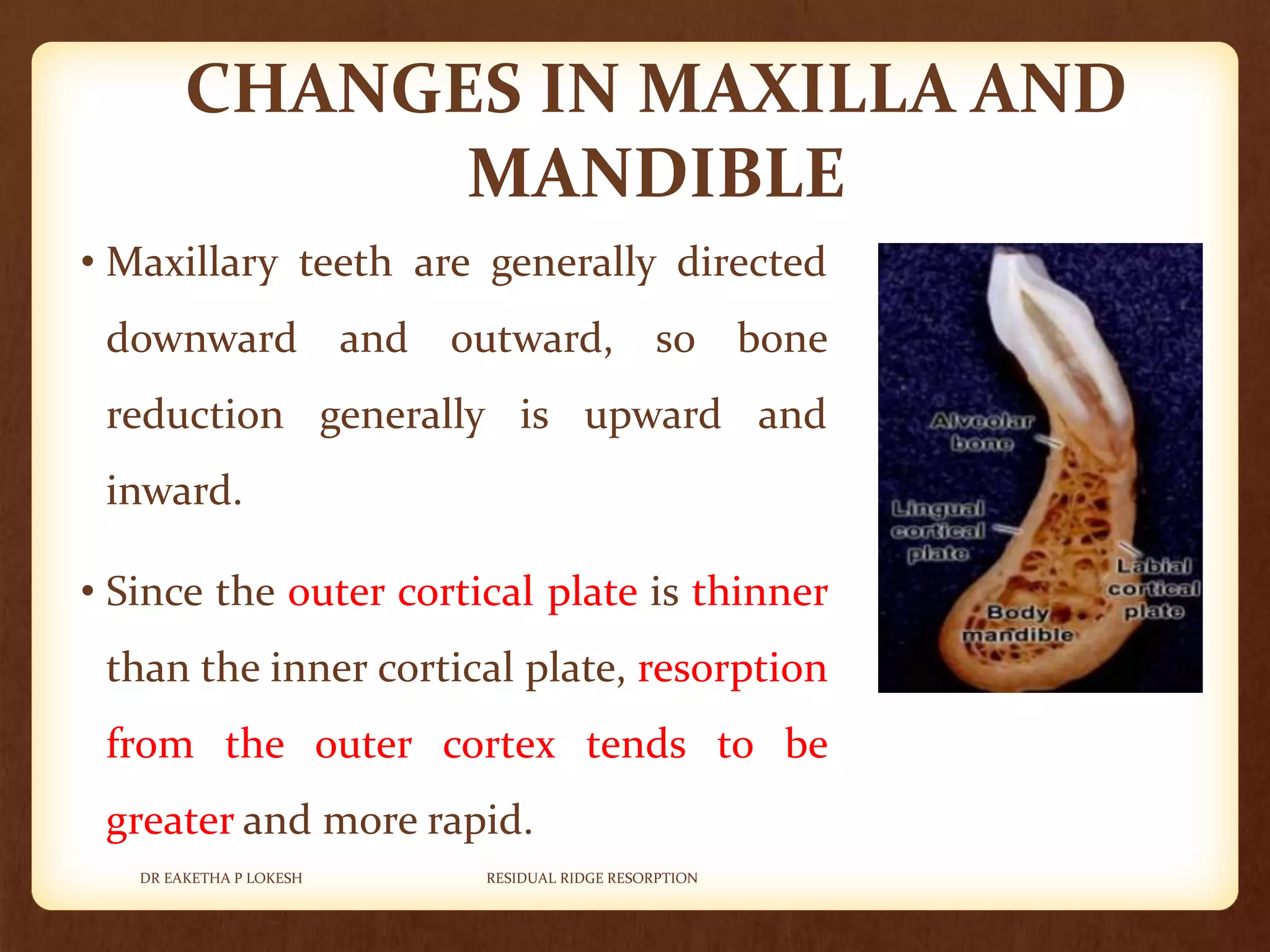 Residual ridge resorption - RRR | PPTX