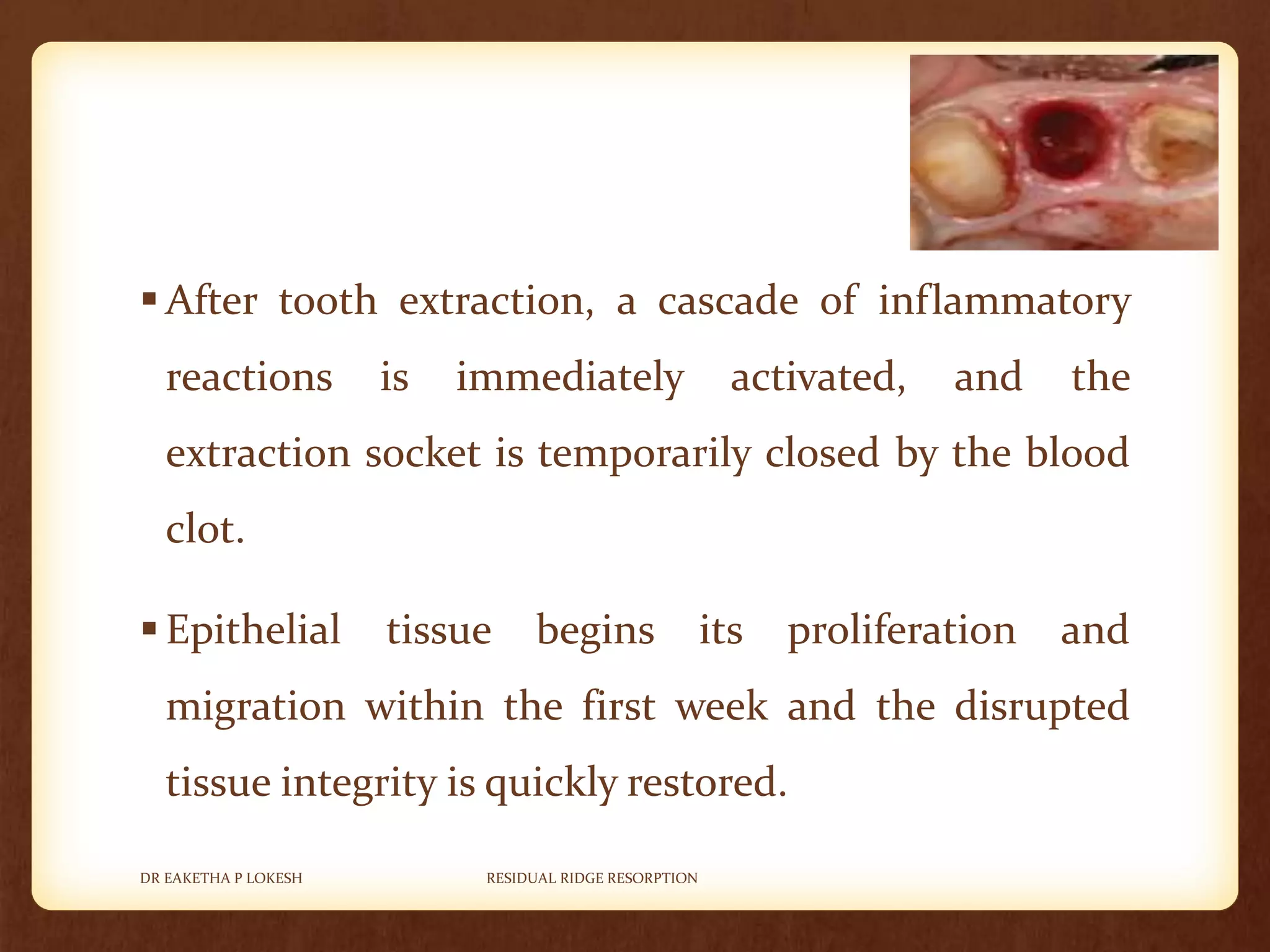 Residual ridge resorption - RRR | PPTX