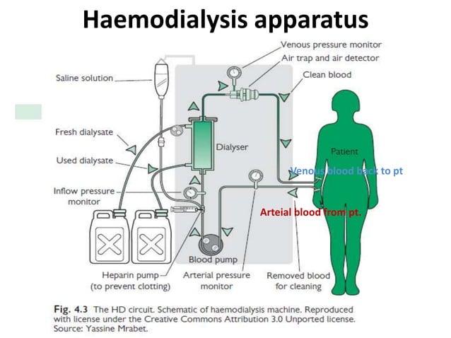 Renal replacement therapy AND HD P1.pptx