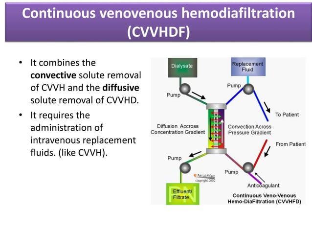 Renal Replacement Therapy: modes and evidence | PPTX