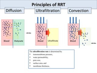 Renal Replacement Therapy: modes and evidence | PPTX