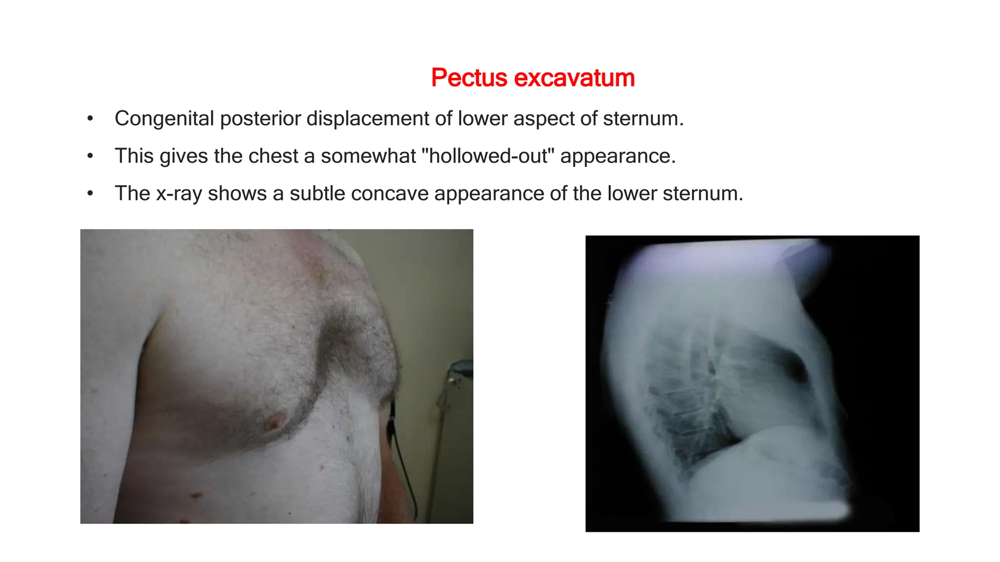 Clinical Examination of Respiratory System | PPTX