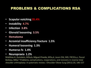 Reverse Shoulder Arthroplasty | PPTX | Death, Injury, or Military ...