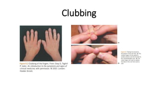 Respiratory examination Chamberlain medicine | PDF