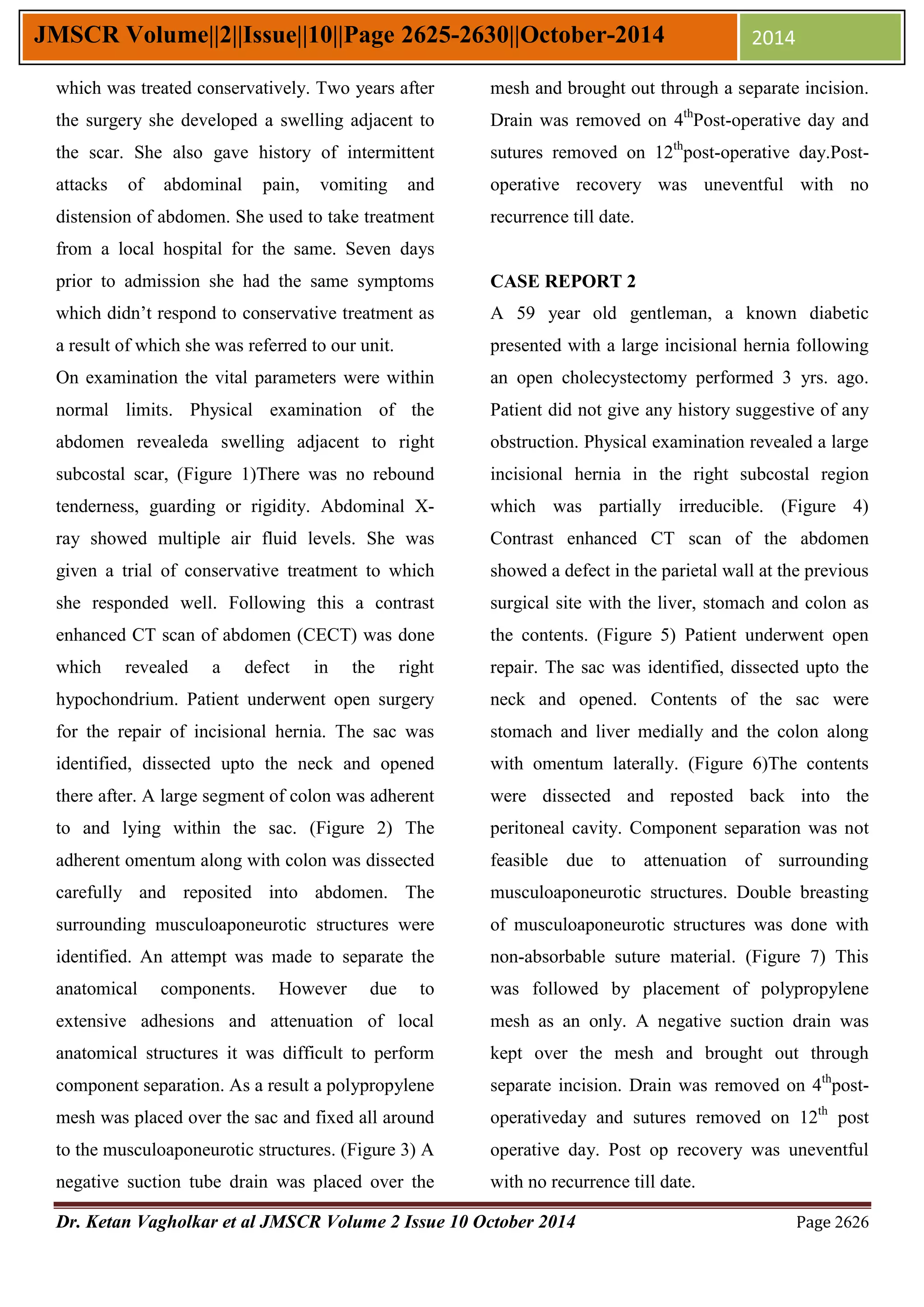 Right Subcostal Incisional Hernia: A Surgical Challenge. | PDF
