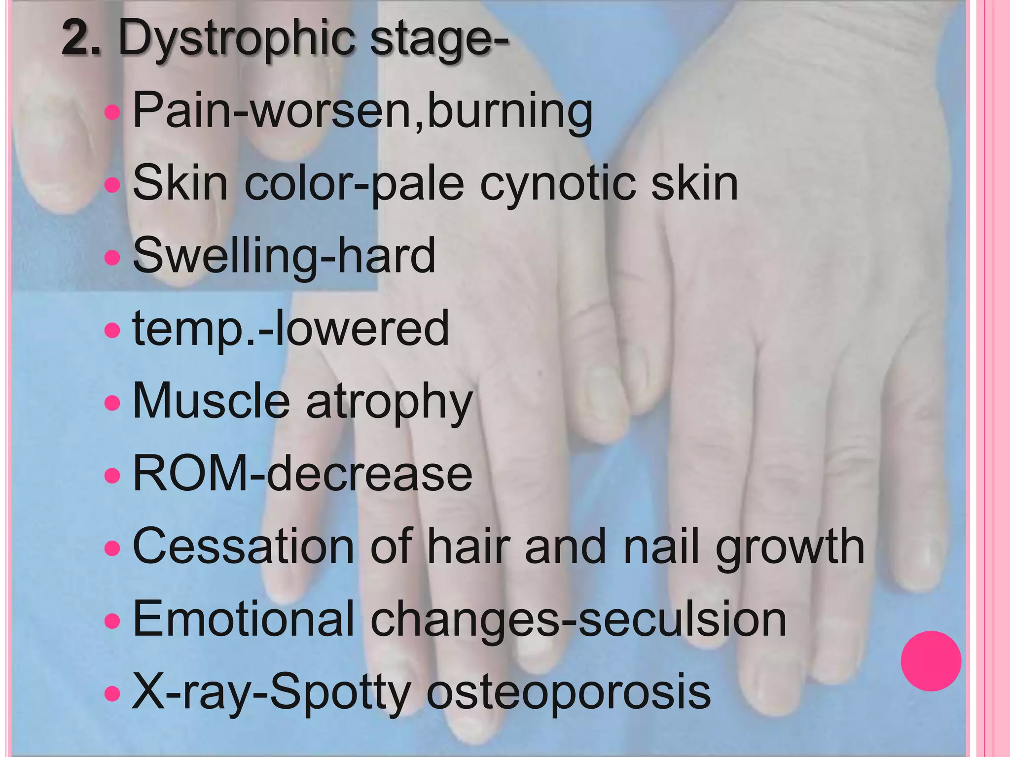 RSD-REFLEX SYMPATHETIC DYSTROPHY | PPTX