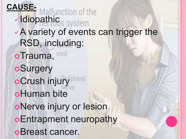 RSD-REFLEX SYMPATHETIC DYSTROPHY | PPTX | Brain and Nervous System Disorders | Diseases and ...