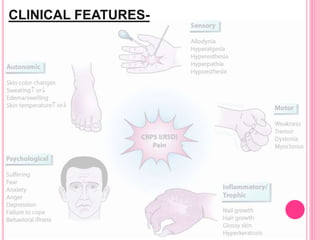 RSD-REFLEX SYMPATHETIC DYSTROPHY | PPTX