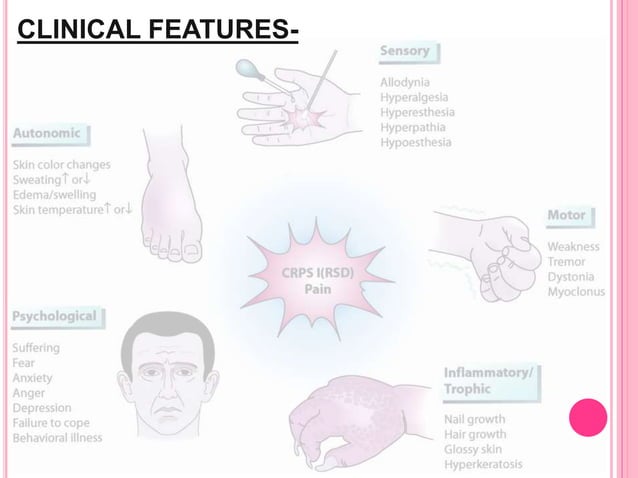 RSD-REFLEX SYMPATHETIC DYSTROPHY | PPTX | Brain and Nervous System ...