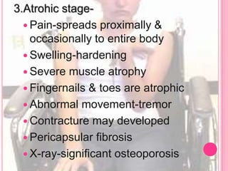 RSD-REFLEX SYMPATHETIC DYSTROPHY | PPTX