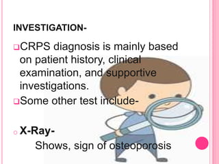 RSD-REFLEX SYMPATHETIC DYSTROPHY | PPTX