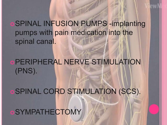 RSD-REFLEX SYMPATHETIC DYSTROPHY | PPT