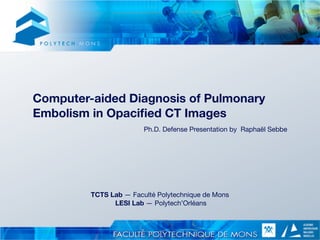 Computer-aided Diagnosis of Pulmonary Embolism in Opacified CT Images | PPT