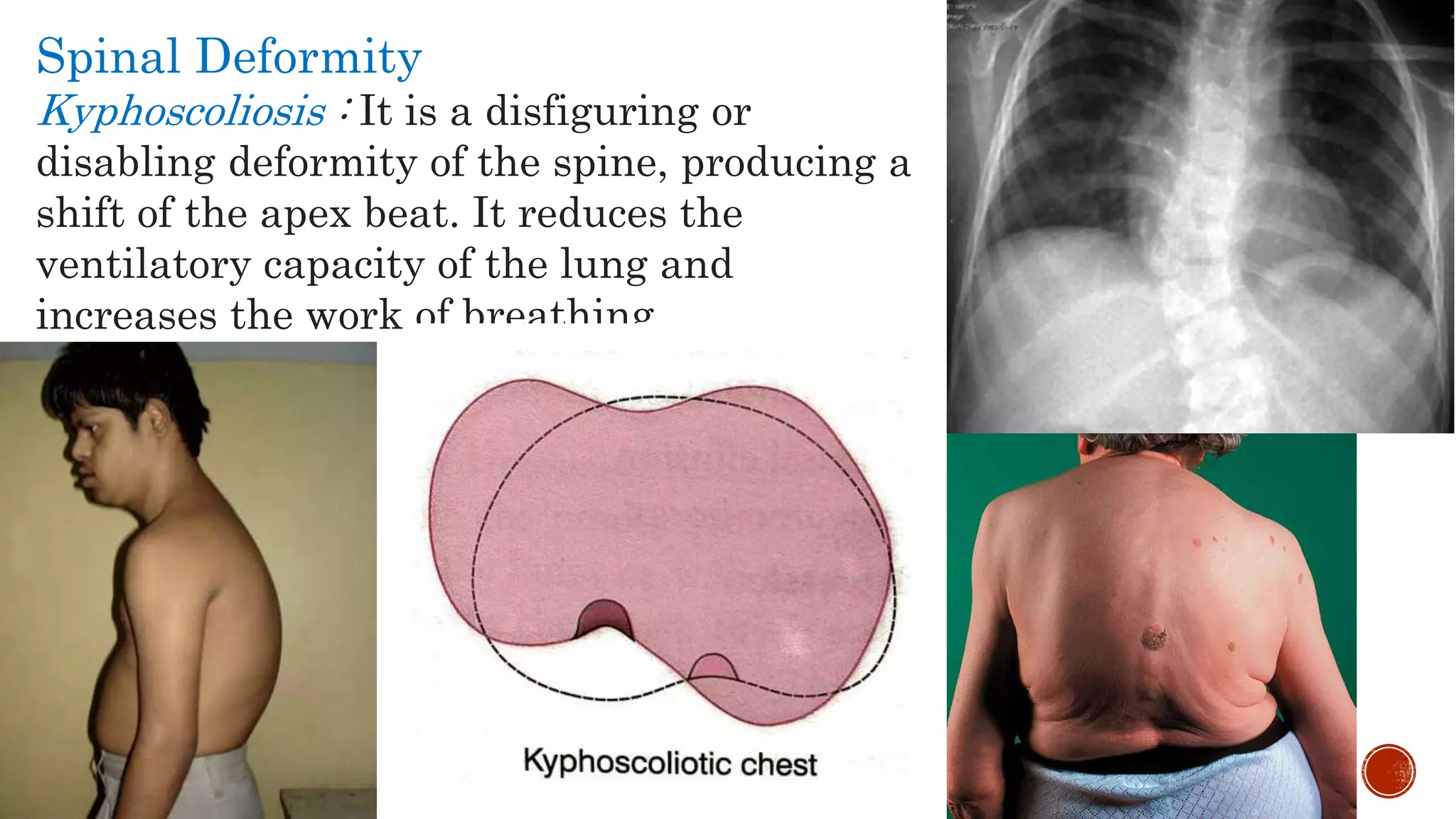 Clinical Examination of RS | PPTX