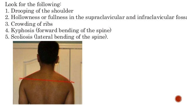 Clinical Examination of RS