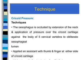 Rapid sequence intubation | PPT