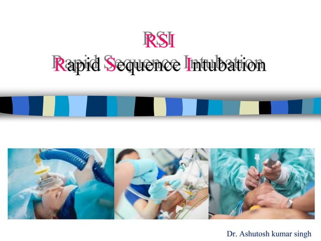 Rapid sequence intubation