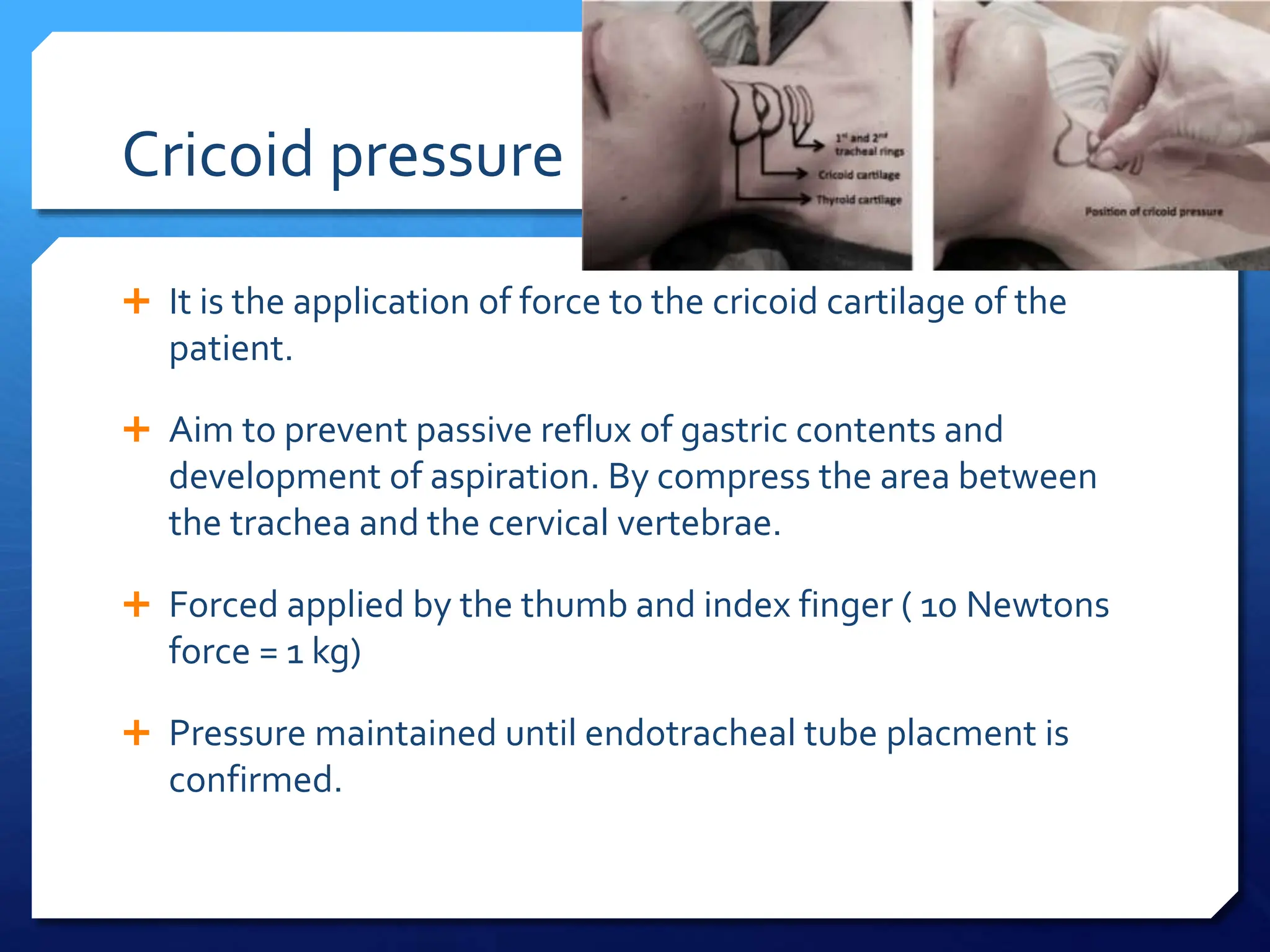 Rapid sequence induction (RSI) | PPTX