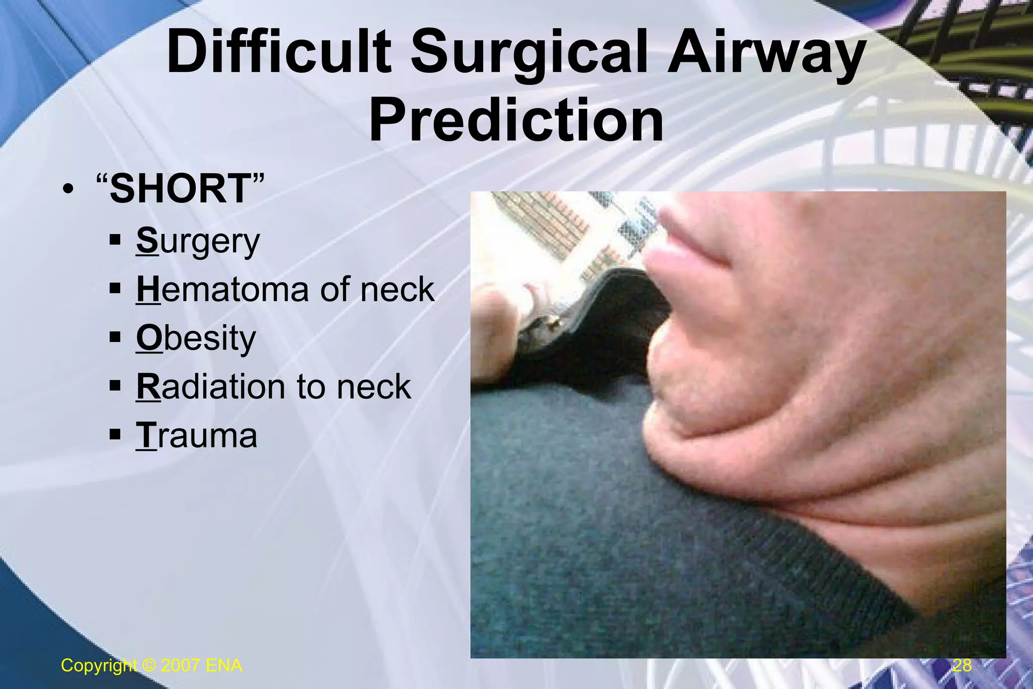 Indiana ENA 2010 RSI And Difficult Intubation | PPT