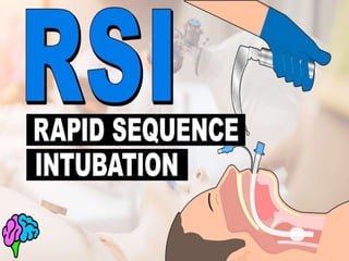 Rapid sequence induction drugs #intubation | PPTX