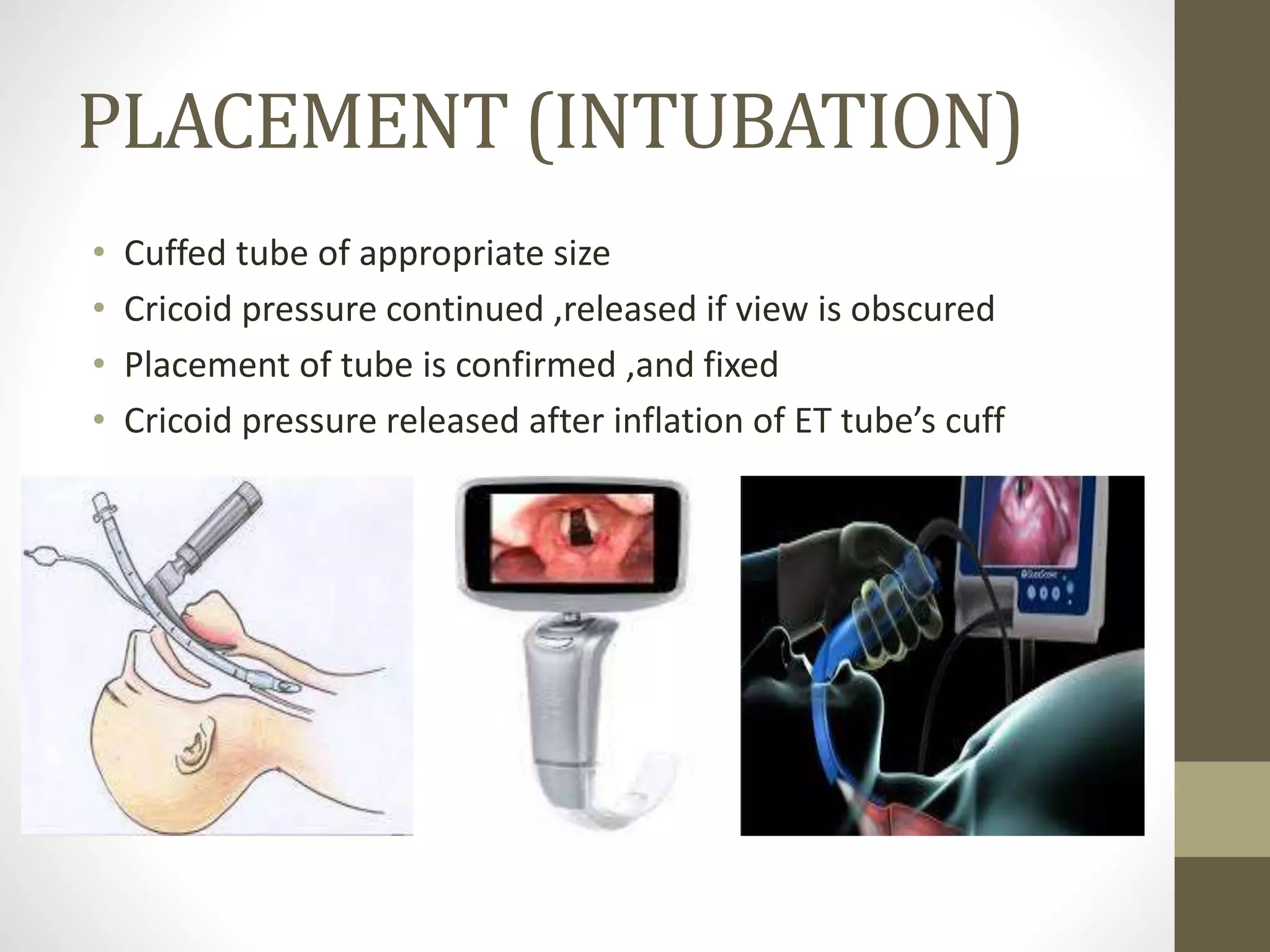 Rapid Sequence Induction & Intubation | PPTX