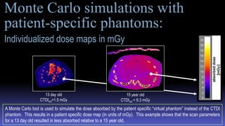 Rsna2012 pediatric dosemapvstdphantom | PPTX